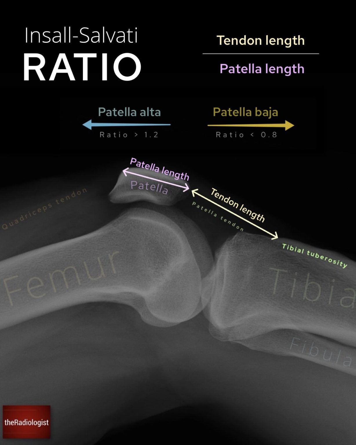 Knee X-Ray Guide – the Radiologist